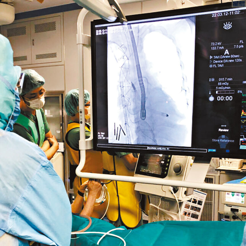 Impella 心臟泵致49死 FDA發最高級別警告 | 星島日報